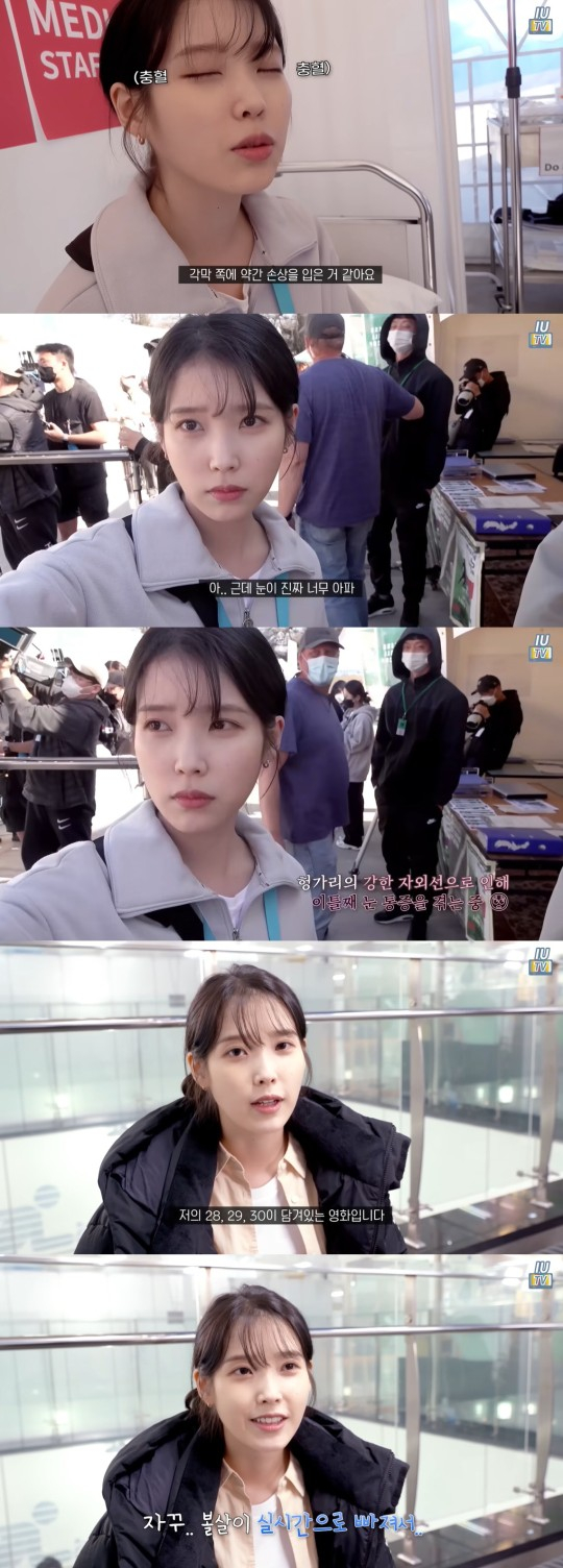 아이유 각막 손상 입은 것 같아… 드림 촬영 중 무슨 일 머니s